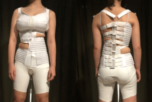 Preliminary wear trial of anisotropic textile brace designed for ...